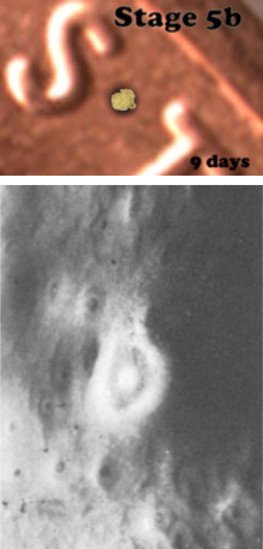 The Stages of Human Embryonic Development - Action Life